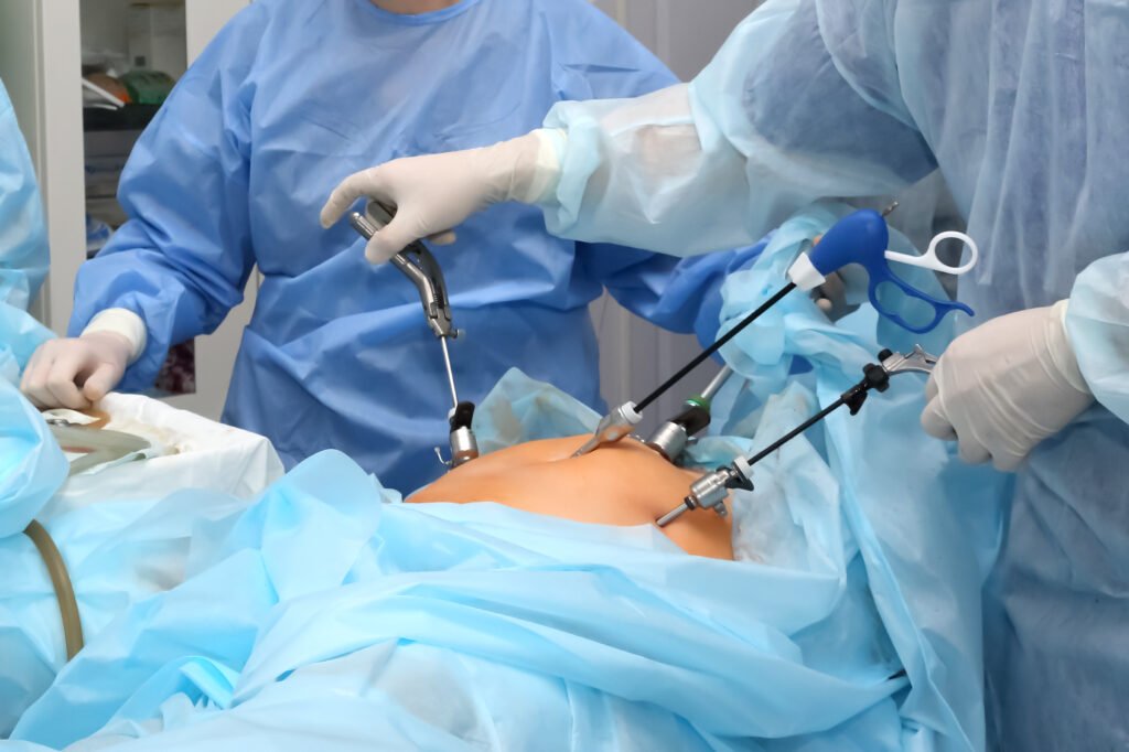 Laparoscopic Surgeries - Samartha hospital
